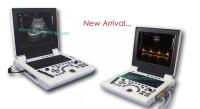 China Laptop Ultrasound Machine with 12-inch HD Display and 3200mAh Battery - PW Doppler THI Imaging Technology for sale