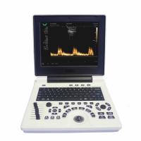 China USG OB GYN Portable Ultrasound Machine with IMT Automatic Measurement 12.1