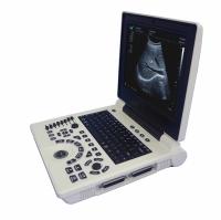 China P20 Portable B/W Ultrasound Machine with 12.1