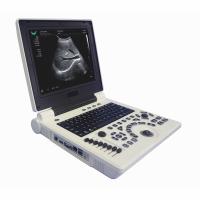 China USG OB GYN Portable Ultrasound Machine with IMT Automatic Measurement 12.1