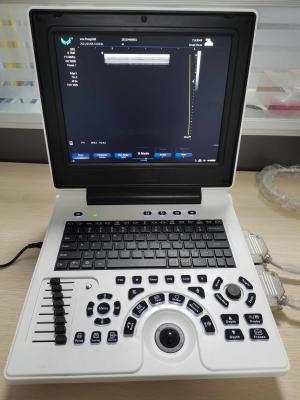 China P20 Portable B/W Ultrasound Machine with 12.1