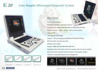 China ISO Basic Level Portable USG Machine Digital Color Doppler Ultrasound System with 12.1
