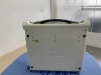 China E20 Laptop Color Doppler Ultrasound Machine with 12.1-inch Display and 3200mAh Battery for Medical Diagnostics for sale