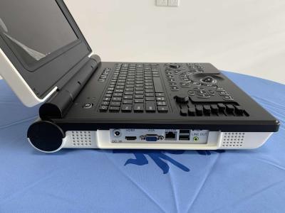 China ISO Basic Level Portable USG Machine Digital Color Doppler Ultrasound System with 12.1