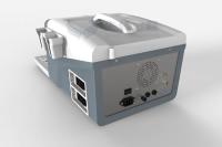 China XF218 Veterinary Portable Ultrasound Scanner with 3.5MHz Probe, 256 Gray Scale and 2 SVGA Output for Livestock for sale