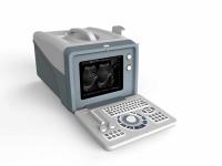 China Xianfeng XF218 CRT Portable Ultrasound Scanner with 3.5MHz Probe and 256 Image Storage for Pregnancy Monitoring for sale