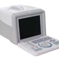 China XF218 Portable 2D Ultrasound Scanner with 3.5MHz Convex Probe, 256 Gray Scale for Physiotherapy Applications for sale
