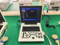 China XF30B Notebook Ultrasound Scanner with 12.1