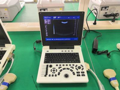 China XF30B Notebook Ultrasound Scanner with 12.1