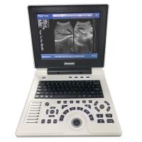 China XF30A 12.1 Inch Portable Ultrasound Scanner with 3.5MHz Convex Probe and 11.1V 3000mAh Battery for sale
