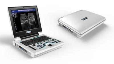 China XF30B Notebook Ultrasound Scanner with 12.1 Inch Display and 2+ Hour Li Battery for Hospital Use for sale