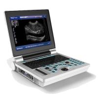 China XF30A 12.1 Inch Portable Ultrasound Scanner with 3.5MHz Convex Probe and 11.1V 3000mAh Battery for sale