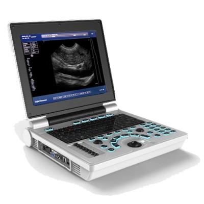 China XF30A 12.1 Inch Portable Ultrasound Scanner with 3.5MHz Convex Probe and 11.1V 3000mAh Battery for sale