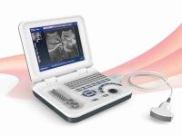 China 10.4-inch Notebook Veterinary Ultrasound Machine with 3.5MHz Convex Probe and 11.1V Battery for Multi-Species Diagnostics for sale