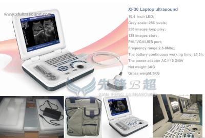 China Medical Ultrasound Imaging System with 10.4-inch Display and 3.5MHz Convex Probe for Pregnancy Monitoring for sale