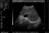 China Medical Ultrasound Imaging System with 10.4-inch Display and 3.5MHz Convex Probe for Pregnancy Monitoring for sale