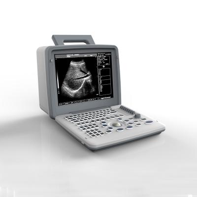 China XF300 Digital OB/GYN Ultrasound Scanner with 12-inch LED Display and 0-120dB Dynamic Range for sale