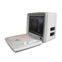 China XF300 Digital OB/GYN Ultrasound Scanner with 12-inch LED Display and 0-120dB Dynamic Range for sale