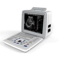 China XF300 Digital OB/GYN Ultrasound Scanner with 12-inch LED Display and 0-120dB Dynamic Range for sale