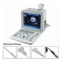 China XF300 Digital OB/GYN Ultrasound Scanner with 12-inch LED Display and 0-120dB Dynamic Range for sale