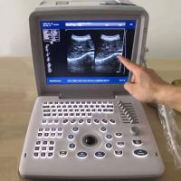 China XF300 Digital OB/GYN Ultrasound Scanner with 12-inch LED Display and 0-120dB Dynamic Range for sale