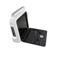China Pediatric Cardiology Ultrasound Machine With Battery HDMI Output for sale