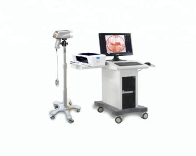 China Digital Video Colposcope for sale