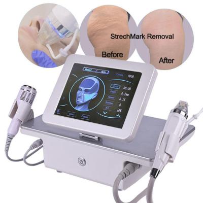 China Portable RF Radio Frequency Machine Microneedling Fractional Stretch Marks Wrinkle Removal for sale