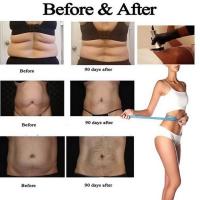China Kim 8 Cavitation Slimming Machine 5 In 1 Vacuum RF ABS Metal for sale