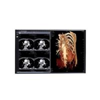 China 10.36 Inch TFT LCD Touch Screen with 1200x2000 Resolution and 10 Point Touch MIPI Display Module for sale