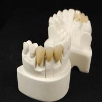 China Co-Cr Crown Cobalt-Chromium Dental Crown with High Durability Biocompatible and Corrosion Resistant for Molars and Premolars for sale