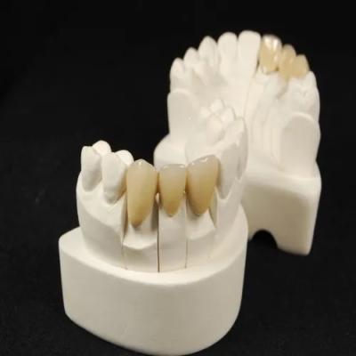 China Co-Cr Crown Cobalt-Chromium Dental Crown with High Durability Biocompatible and Corrosion Resistant for Molars and Premolars for sale