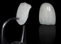 China Emax Veneer Dental Veneer with Flexural Strength up to ~600MPa Seamlessly Blends with Natural Teeth and Mimics Natural Color for sale