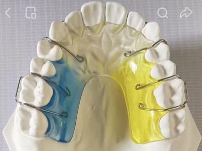 China Custom Molded Hawley Retainer with Adjustable Wire for Long-lasting Teeth Alignment Post-Braces for sale