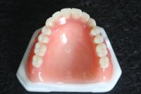 China Lightweight Full Arch Acrylic Denture Custom-fitted for Comfort with Natural Aesthetic Appeal for sale