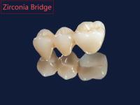 China High Strength Biocompatible Aesthetic Zirconia Dental Crown for Natural Look for sale