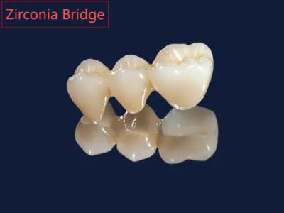 China High Strength Biocompatible Aesthetic Zirconia Dental Crown for Natural Look for sale