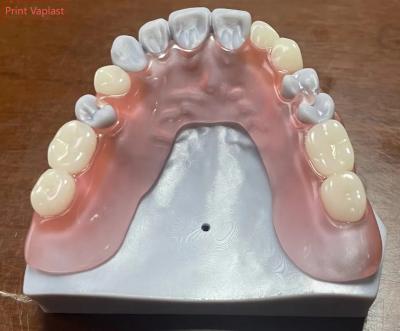 China Valplast Partial Denture with Flexible Nylon Material for Secure Comfort and Natural Appearance for sale