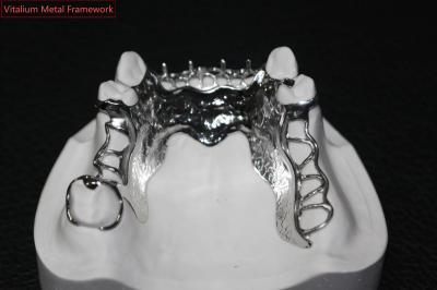 China Titanium Alloy Metal Framework for Removable Dentures - Lightweight and High Corrosion Resistance for sale