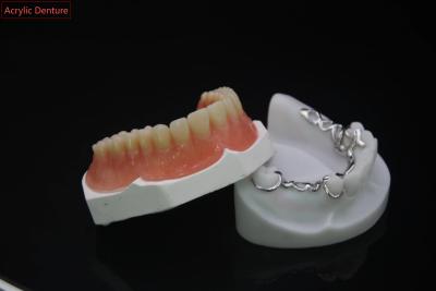China Custom Fit Acrylic Denture with High Quality Acrylic Material and Precision Crafted Natural Appearance for sale