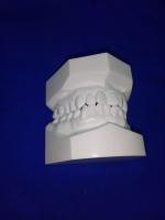 China Dental Study Model with CAD CAM Digital Design and 3D Printing Workflow for Precision Dental Solutions for sale