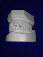 China Dental Study Model with CAD CAM Digital Design and 3D Printing Workflow for Precision Dental Solutions for sale