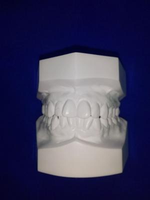 China Dental Study Model with CAD CAM Digital Design and 3D Printing Workflow for Precision Dental Solutions for sale