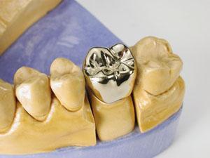China Cobalt Chromium Alloy Dental Crown with CAD/CAM Milling for High Tensile Strength and Permanent Restoration for sale