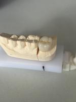 China High Strength 1200 MPa Zirconia Crown with Excellent Biocompatibility and Long-lasting Durability for Dental Restoration for sale