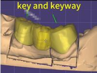 China Key and Keyway for Common Path of Insertion with Precision Fit and Durable Construction for sale