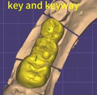 China Key and Keyway for Common Path of Insertion with Precision Fit and Durable Construction for sale