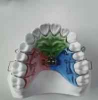 China Biocompatible and Clinically Proven Dental Expander - Custom-fitted Maxillary Expander for Palatal Expansion for sale