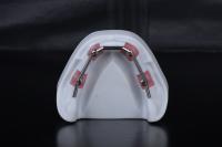 China Titanium Implant and Implant Bar for sale