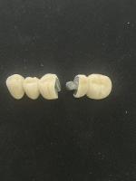 China Precision Fit Durable Key and Keyway for Secure Insertion in Mechanical Applications for sale